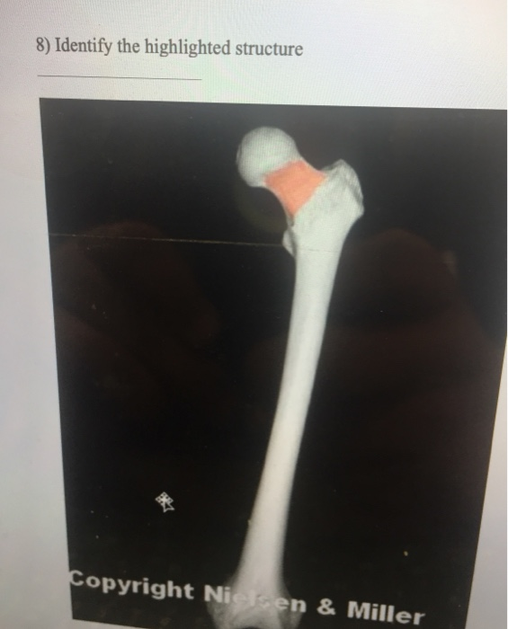 Solved 1) Identify the highlighted area of the following | Chegg.com