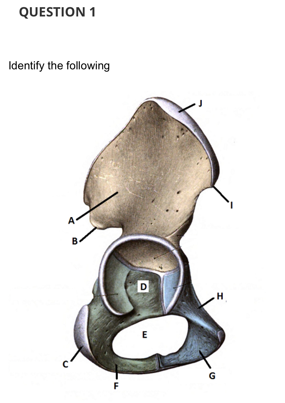 Solved acetabulum anterior inferior iliac spine anterior | Chegg.com