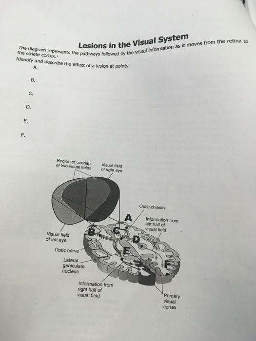 Solved ns in the Visual Sysi o the striate cortex. Identify | Chegg.com