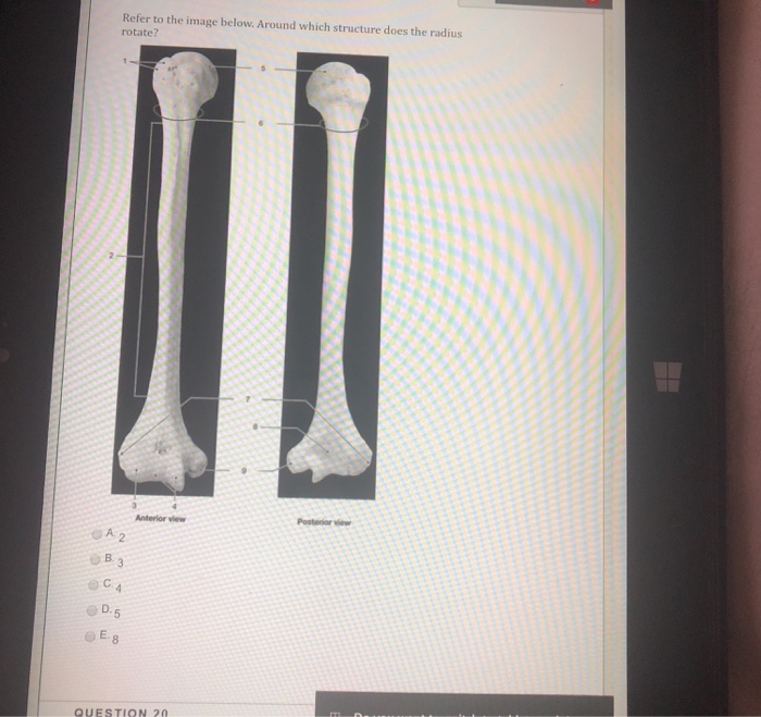 Solved Refer to the image below. Around which structure does | Chegg.com