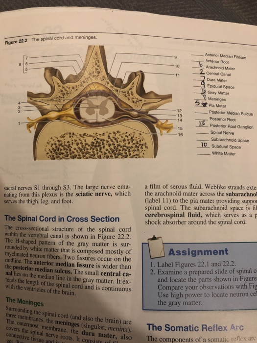 Solved Figure 22.2 The spinal cord and meninges Anterior | Chegg.com