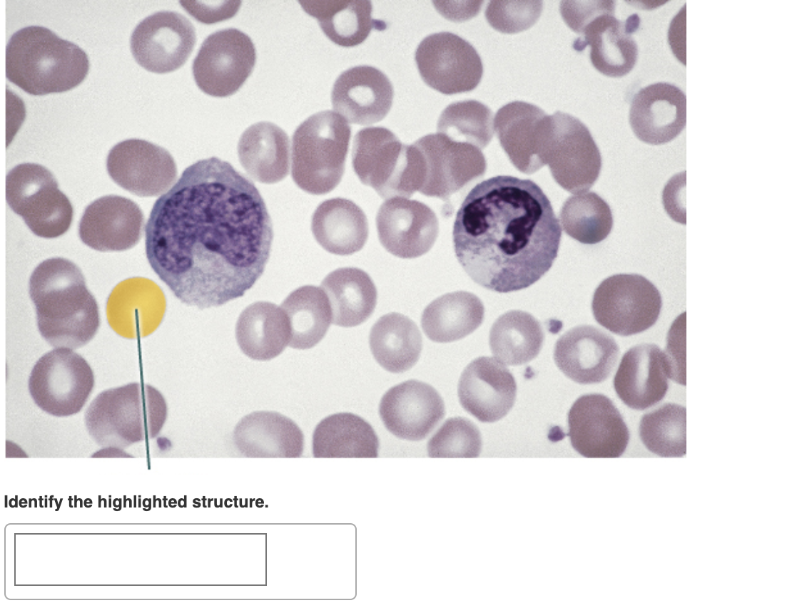 Solved Identify the highlighted cell. Identify the | Chegg.com