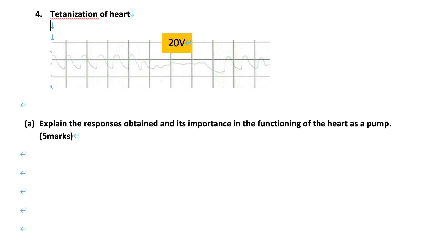 4. Tetanization of heart t 20V (a) Explain the | Chegg.com