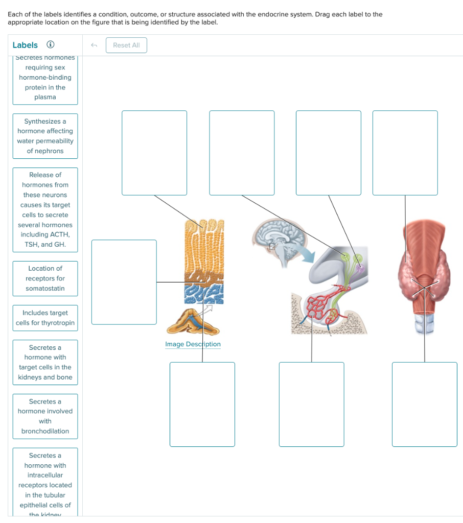 Solved Each of the labels identifies a condition, outcome, | Chegg.com