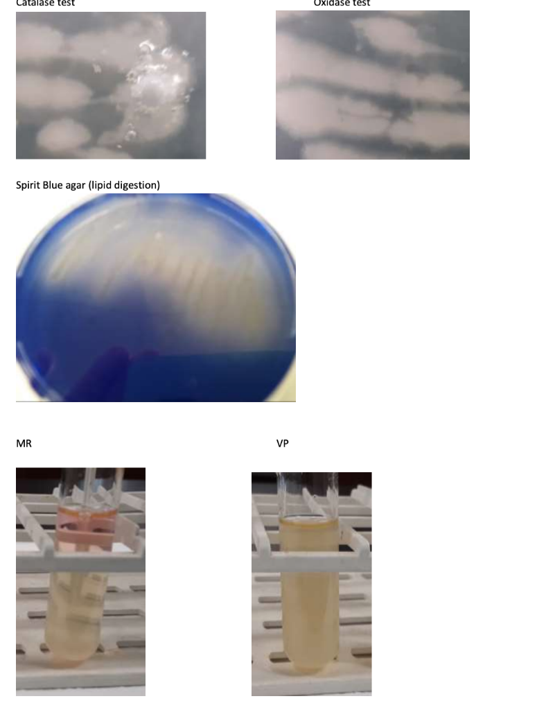 Solved SIM test Glucose TSI MacConkey plate ( growth) EMB | Chegg.com