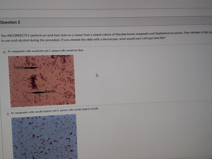 Staphylococcus Aureus Acid Fast Stain