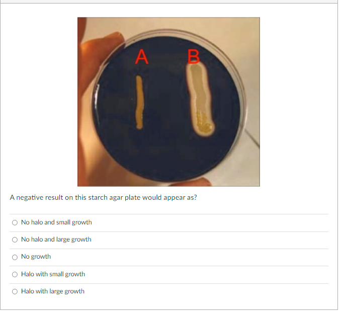 Solved A B. A negative result on this starch agar plate | Chegg.com