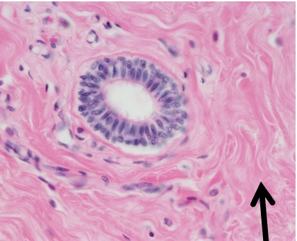 Solved Tissue indicated by the pointer | Chegg.com