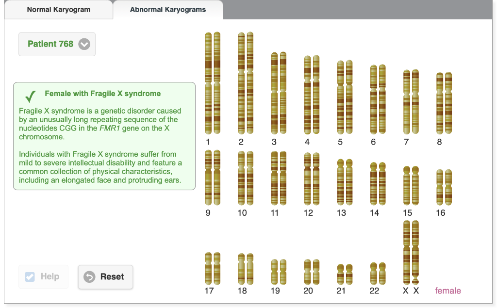 Solved Use the karyotype interactive to answer the question. | Chegg.com