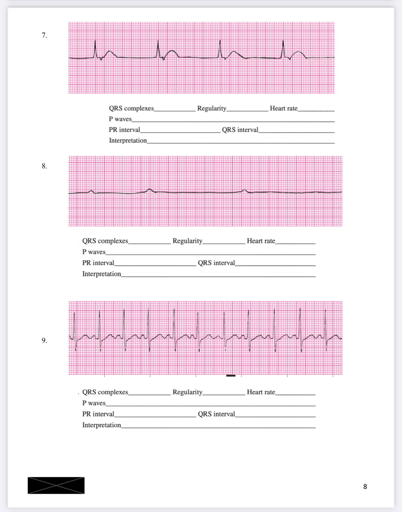 Solved Identify the QRS complexes, regularity, ﻿heart rate, | Chegg.com