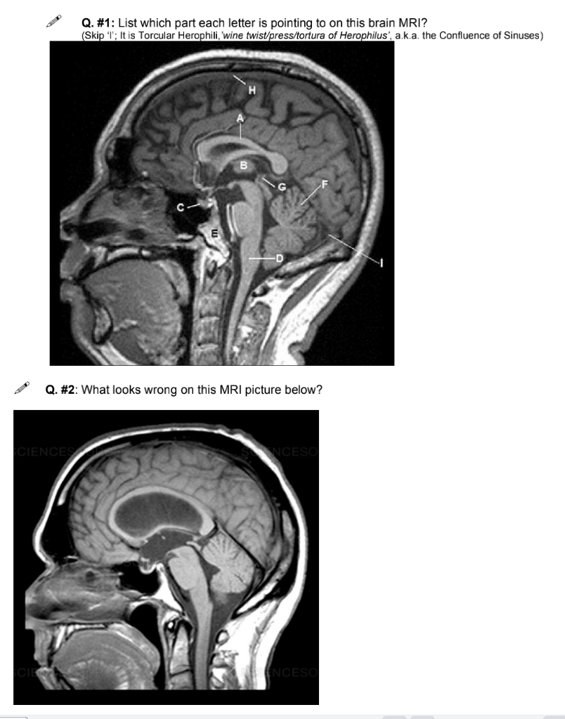 Solved Q. #1: List which part each letter is pointing to on | Chegg.com