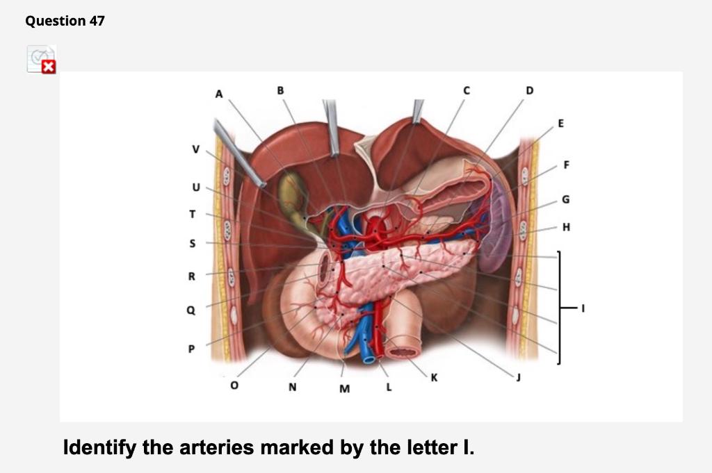 Solved Question 47 x Identify the arteries marked by the | Chegg.com