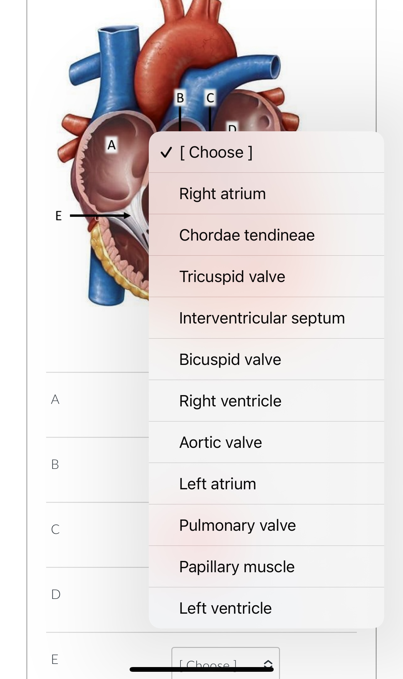 Solved Right atrium | Chegg.com