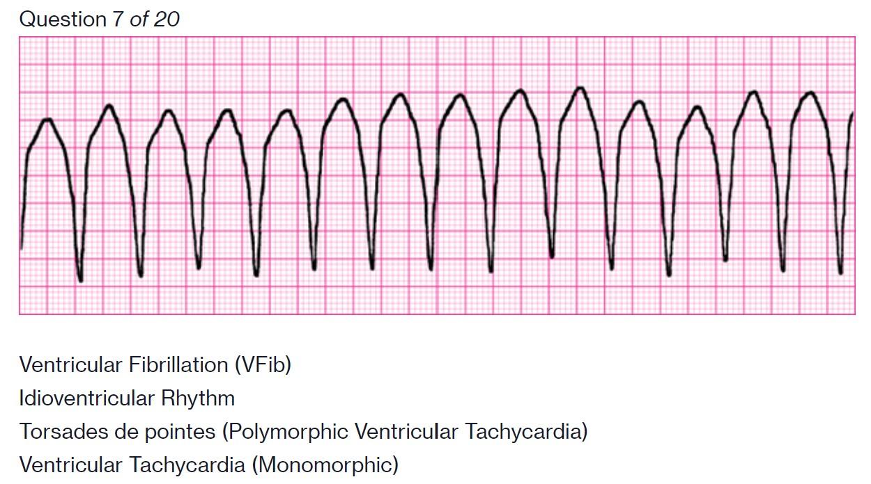 Solved Question 7 of 20 ՈՈՈՈՈՈՈՈՈՈՈՈՈ Ventricular | Chegg.com