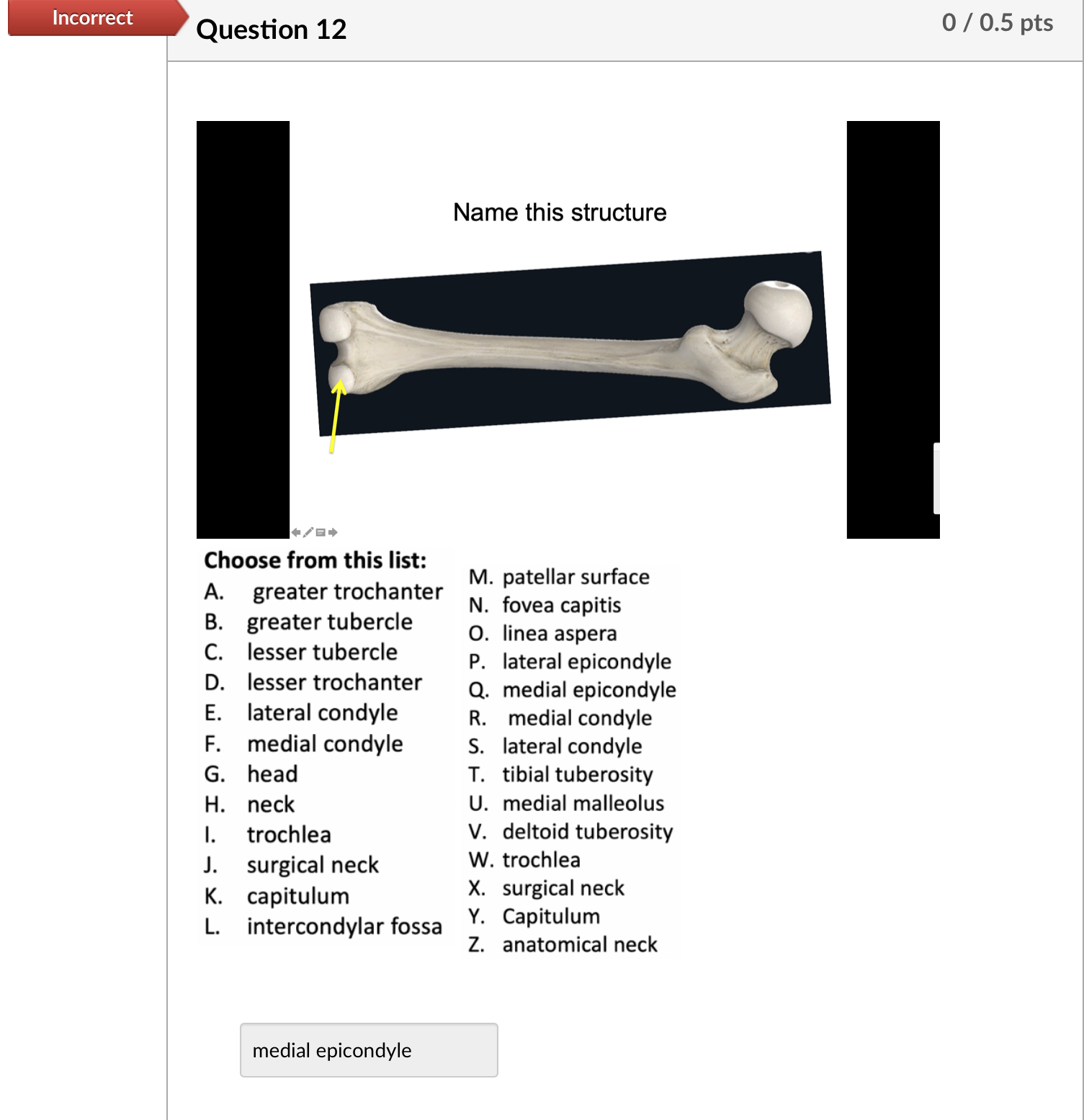 Solved Name this structure A. acromion B. conoid tubercle C. | Chegg.com