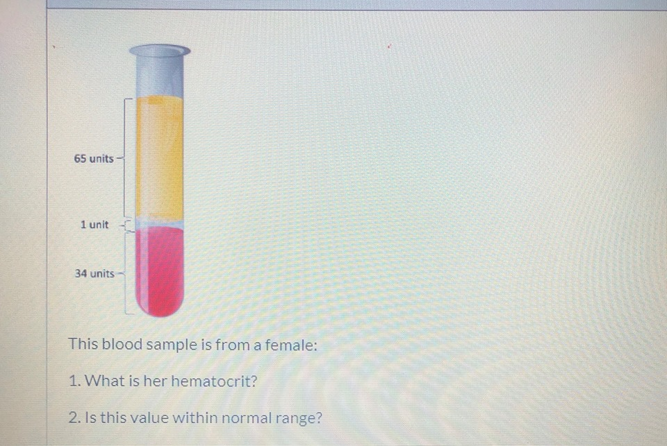 Solved 65 units 1 unit 34 units This blood sample is from a | Chegg.com
