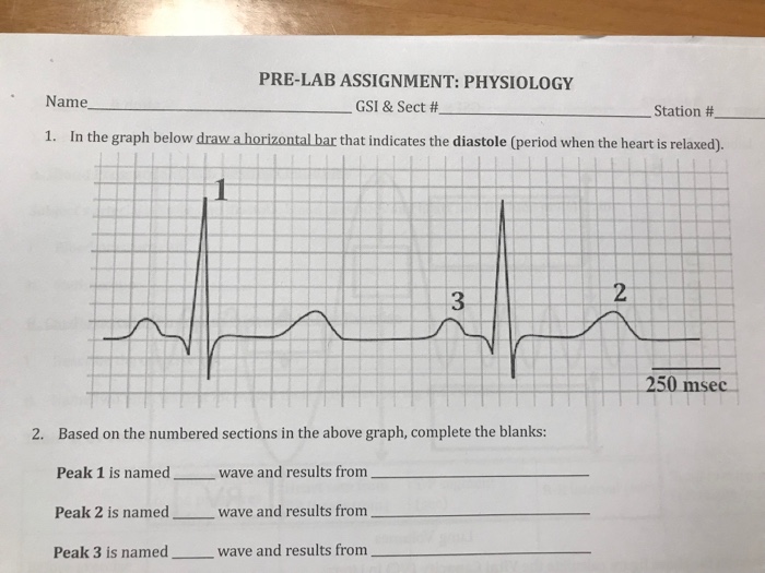 Solved PRE-LAB ASSIGNMENT: PHYSIOLOGY Name GSI & Sect # | Chegg.com