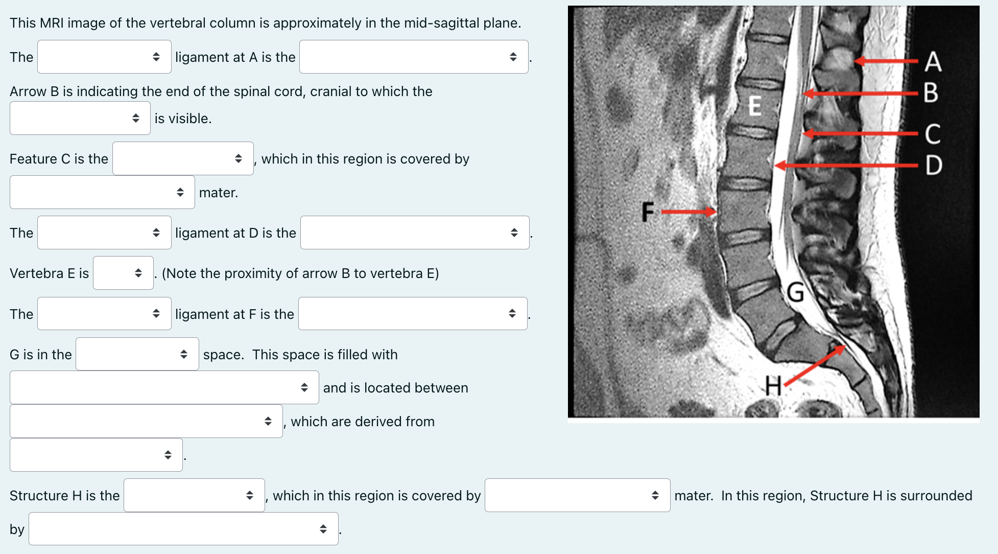 Solved answer all of these: This MRI image of the vertebral | Chegg.com