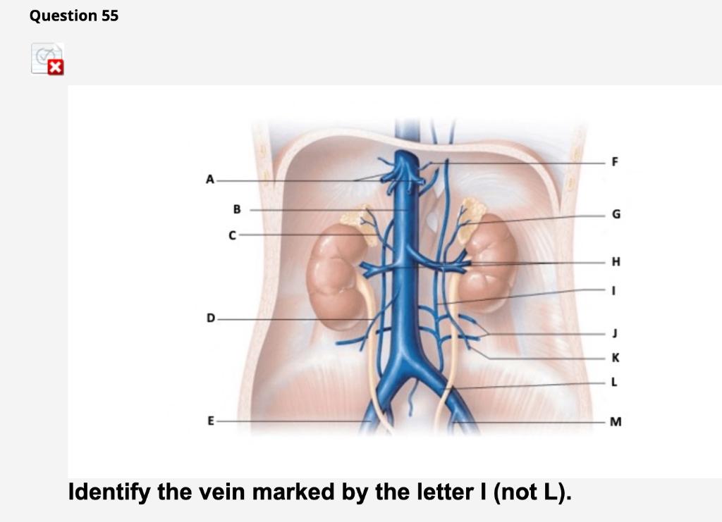 Solved Question 47 x Identify the arteries marked by the | Chegg.com