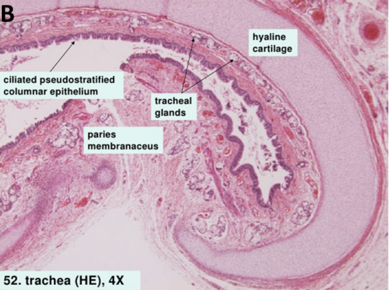 Hyaline Cartilage Trachea Labeled