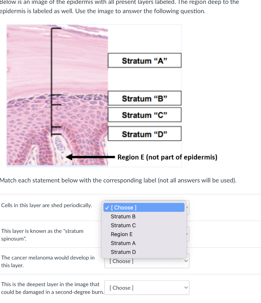 Solved Below is an image of the epidermis with all present | Chegg.com