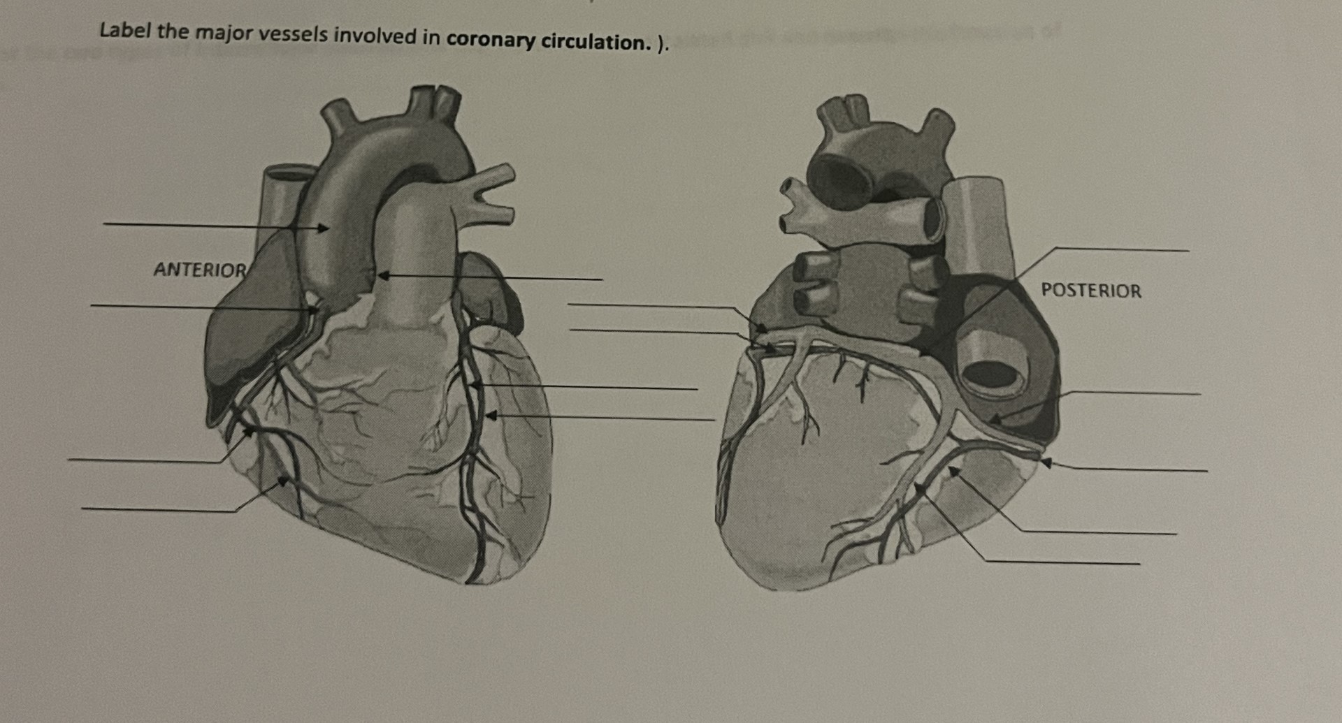 Solved Label the major vessels involved in coronary | Chegg.com