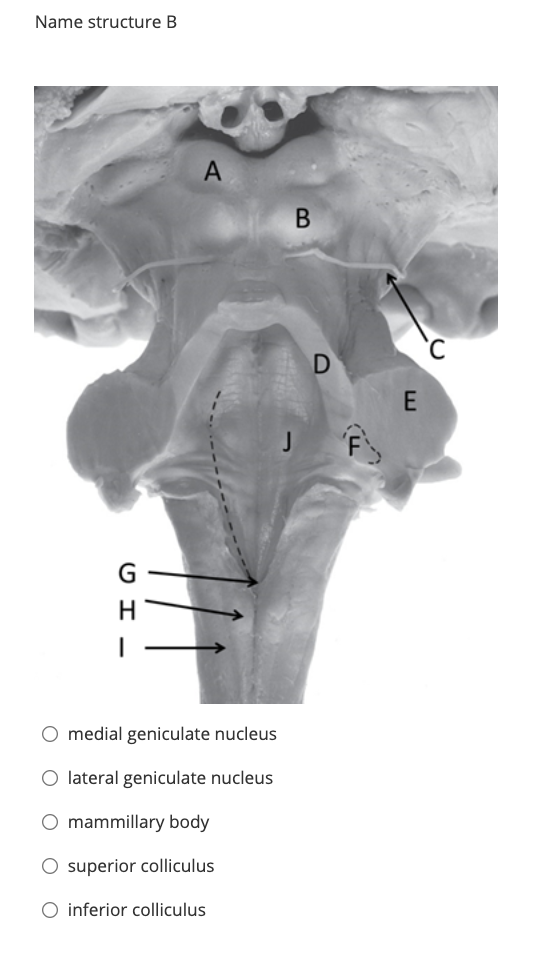 Solved Name structure B A B D UI- H O medial geniculate | Chegg.com