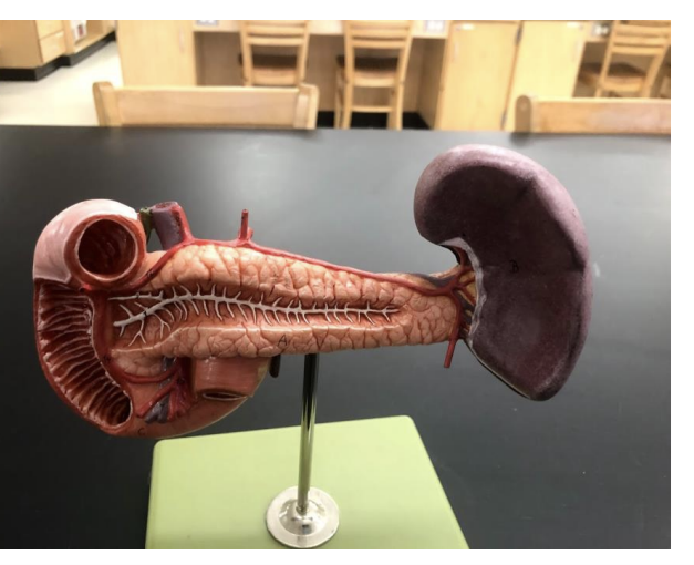 Solved Identify the pancreas,pancreatic duct and the spleen | Chegg.com