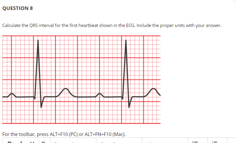 Solved QUESTION 8 Calculate the QRS interval for the first | Chegg.com