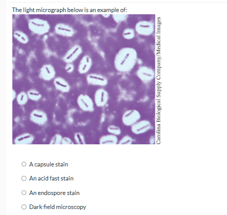The light micrograph below is an example of:A capsule | Chegg.com