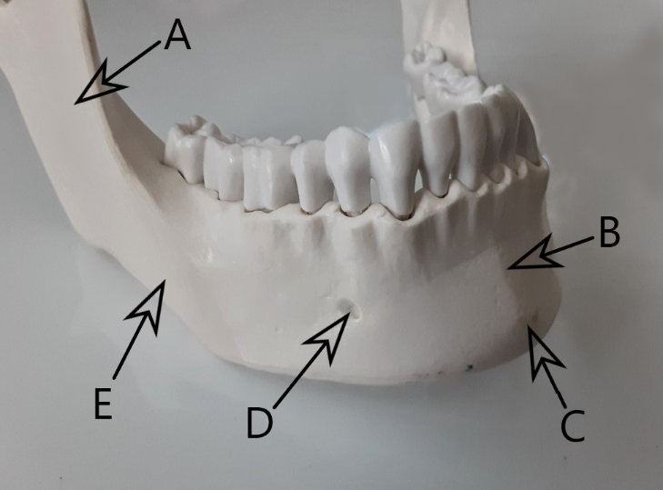 Solved 1.The projection "A" is [ Select ] ["zygomatic | Chegg.com