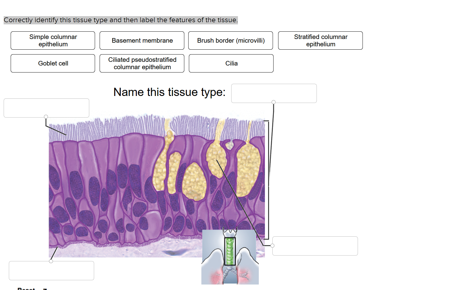 Solved Name this tissue type: | Chegg.com