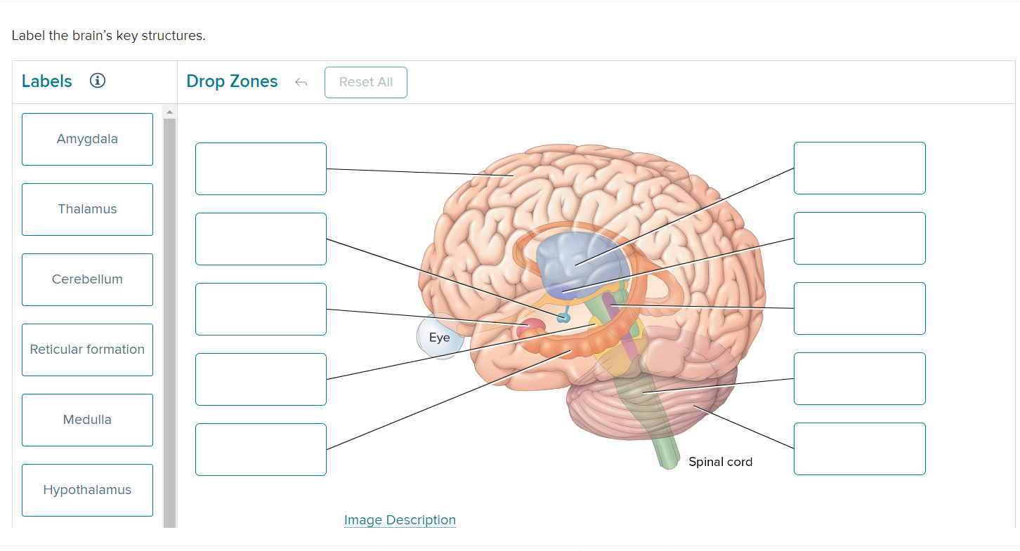 Solved Label the brain's key structures. Image is missing | Chegg.com