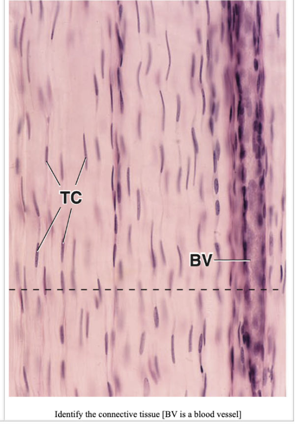 Solved Identify the connective tissue [ BV is a blood | Chegg.com