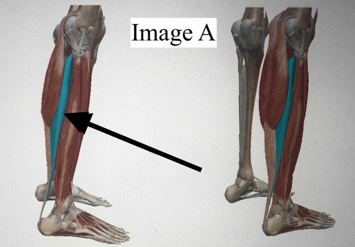 Solved Identify the correct term (muscle, bony marking, | Chegg.com