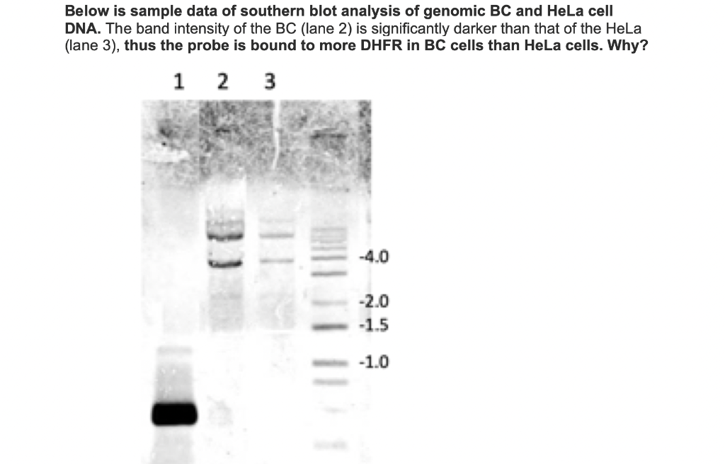 Solved Below is sample data of southern blot analysis of | Chegg.com