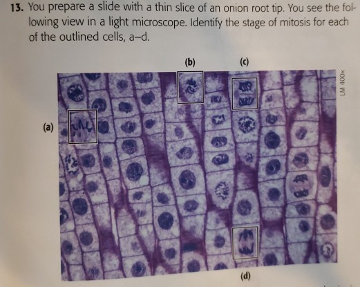 Solved 13. You prepare a slide with a thin slice of an onion | Chegg.com