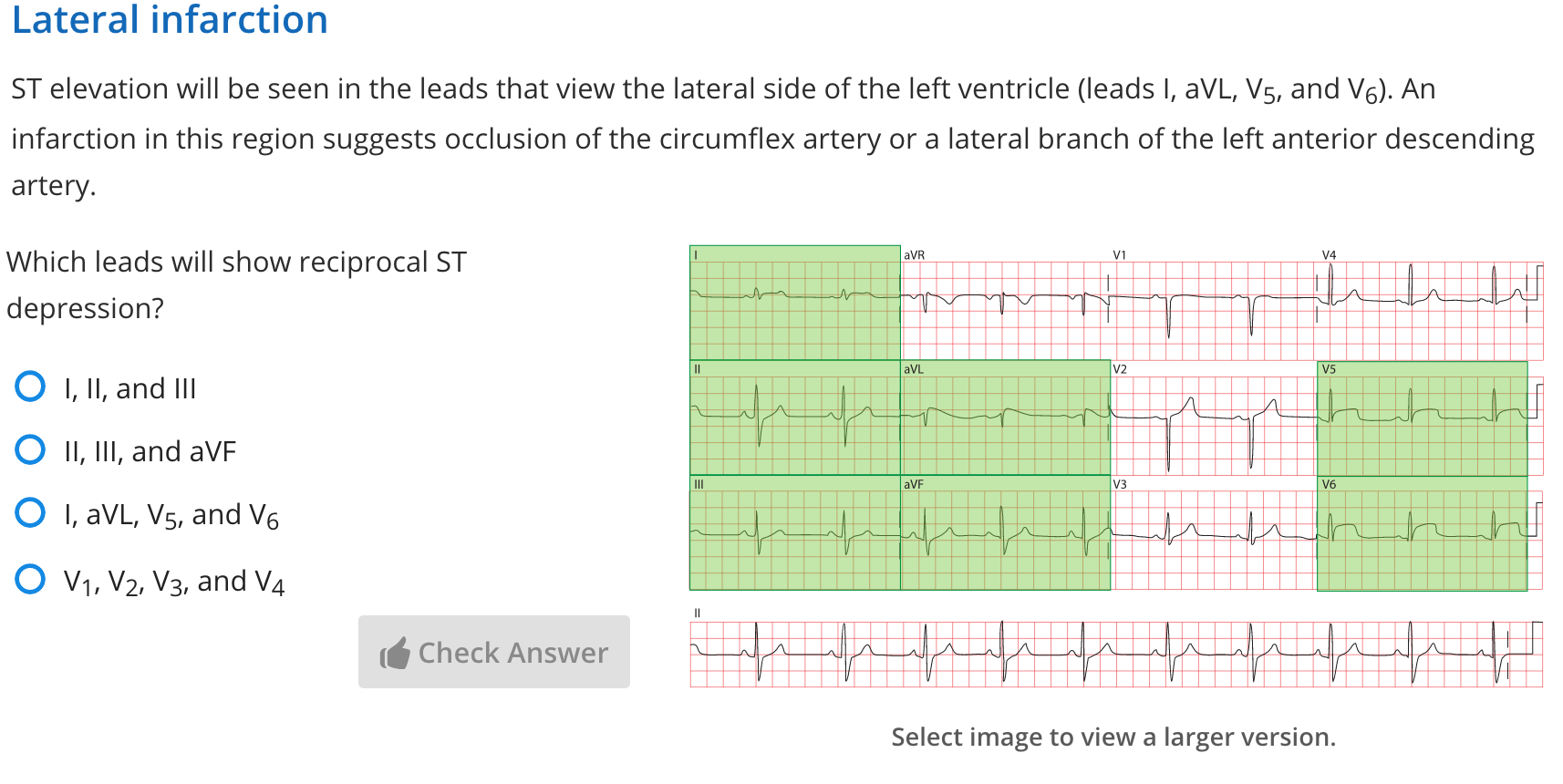 Solved Lateral infarction ST elevation will be seen in the | Chegg.com