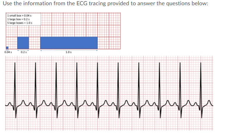 Solved Use the information from the ECG tracing provided to | Chegg.com