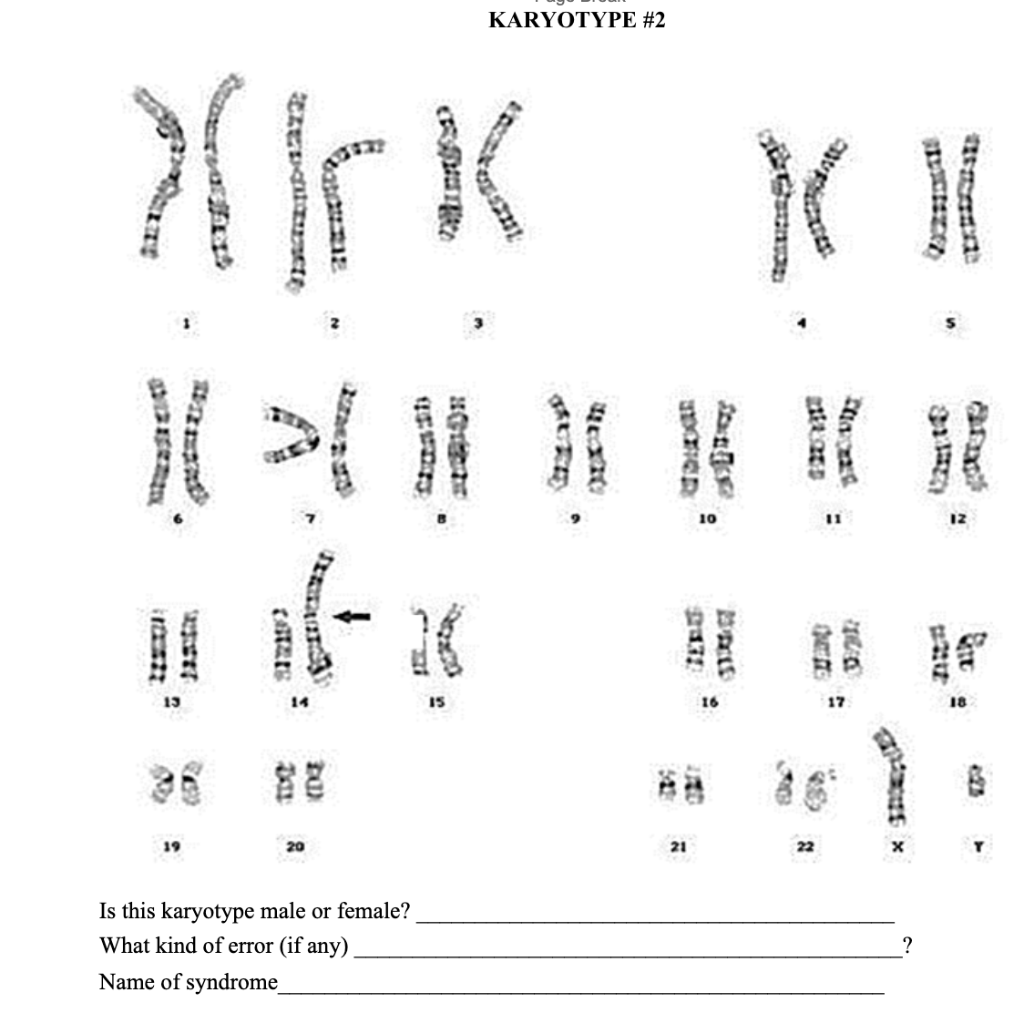 Solved KARYOTYPE #2 CZEMURET UDAR 10 TELE 13 Is this | Chegg.com