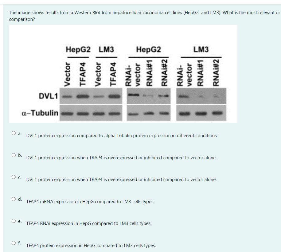 Solved The image shows results from a Western Blot from | Chegg.com