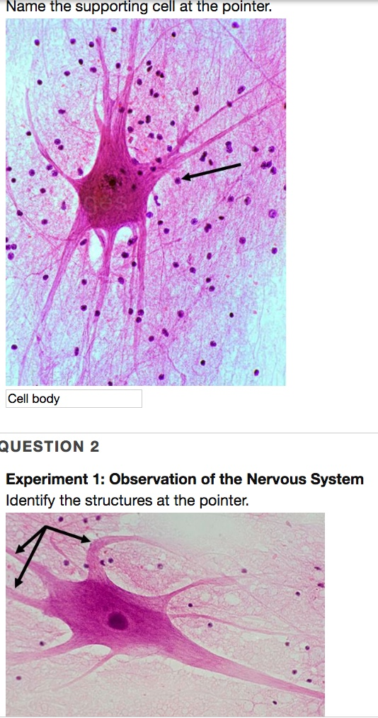 Solved Name the supporting cell at the pointer. Cell body | Chegg.com