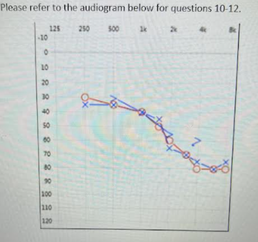 Solved Please refer to the audiogram below for questions | Chegg.com