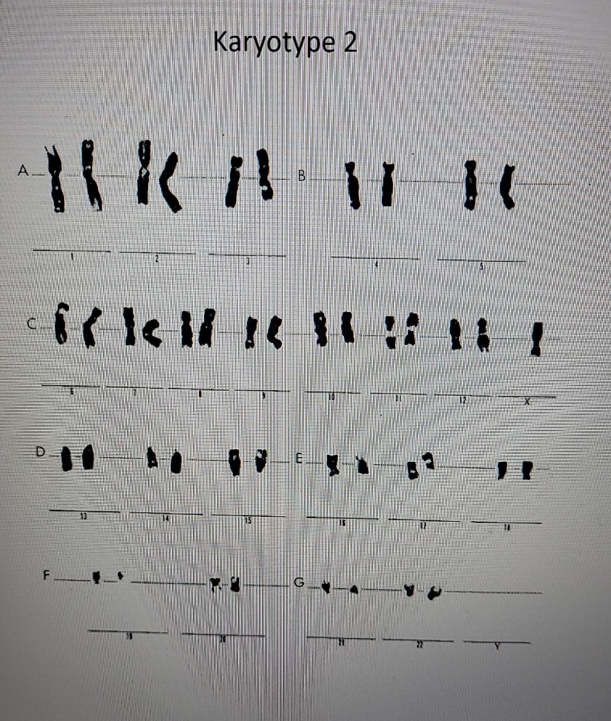 Solved Eqoys Table 9.2 Examples of Human Diseases Detectable | Chegg.com
