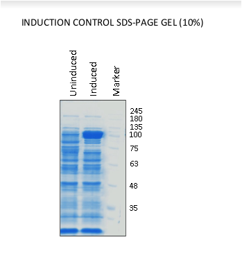Solved In the experiment, we introduced 5uL of BSA standard | Chegg.com