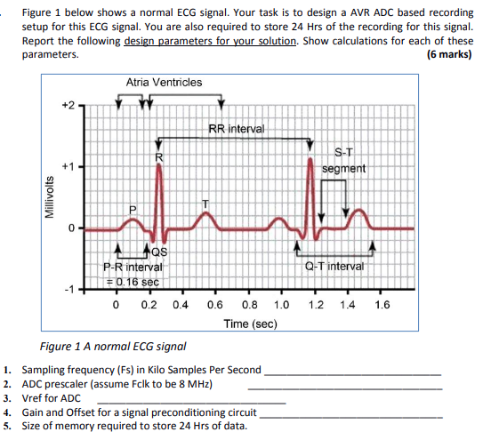 Figure 1 below shows a normal ECG signal. Your task | Chegg.com