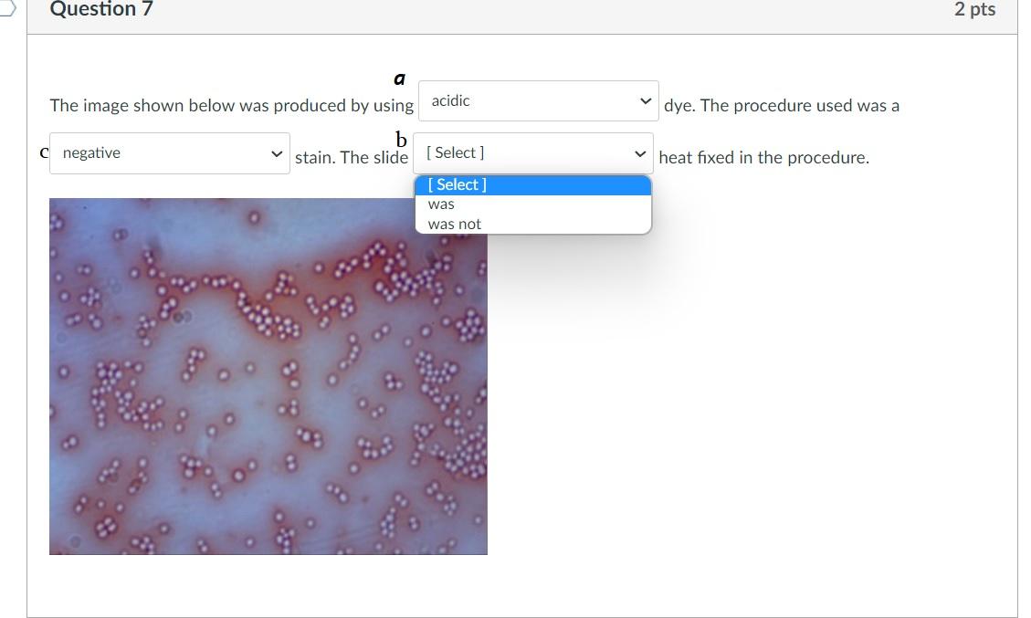Solved hello can you help me solve this please The image | Chegg.com