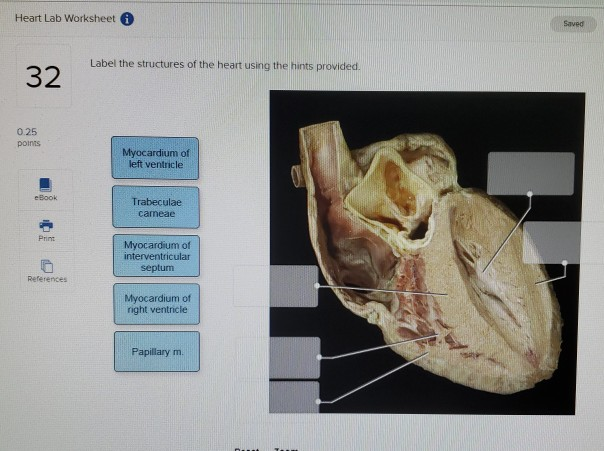 Solved Heart Lab Worksheet i Label the structures of the | Chegg.com