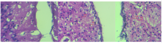 Mice brain H&E staining H&E staining | Chegg.com