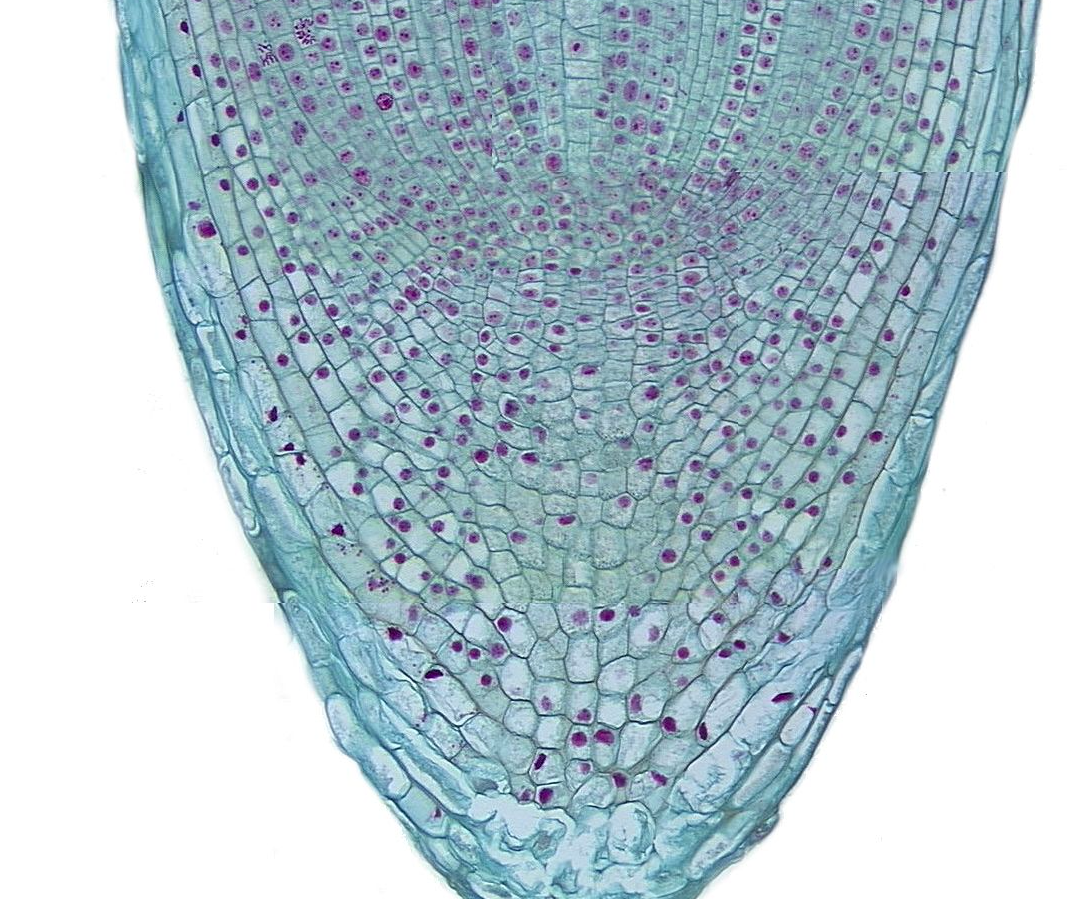 Solved This is the first onion root tip slide. Magnify the | Chegg.com